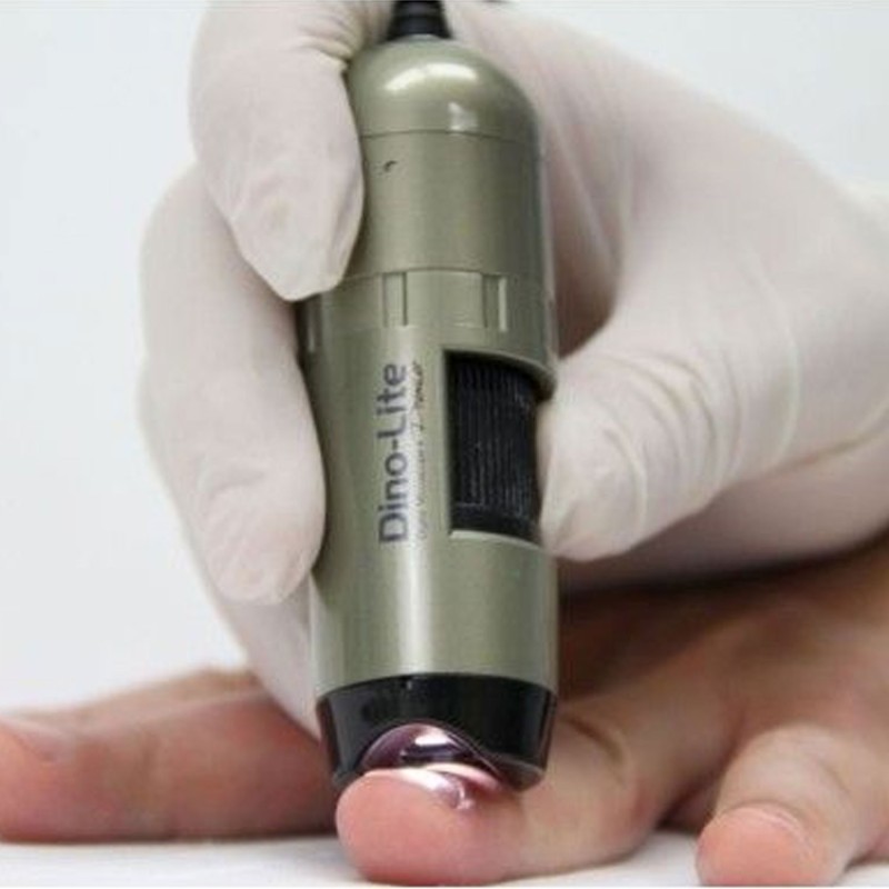 Capilaroscopio Dino-Lite 500 MEDL4N5 | Quantum Spain