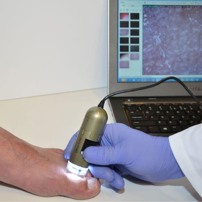 Microscopio Digital Dino-Lite Podoscopio MEDL4FW | Quantum Spain