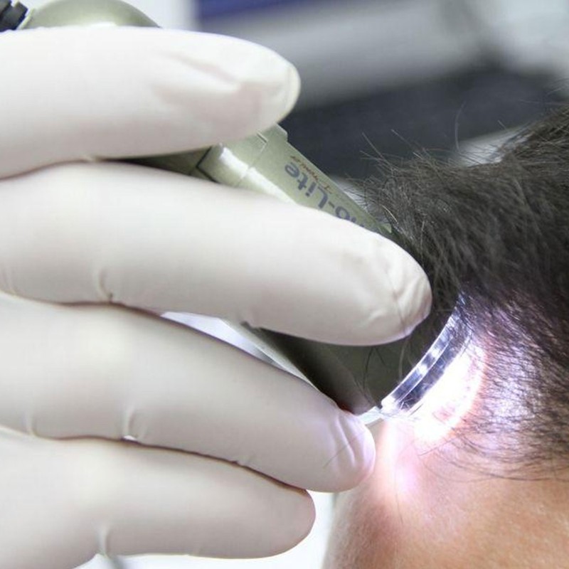 Tricoscopio Dino-Lite TrichoScope Polarizer HR MEDL7HM | Quantum Spain