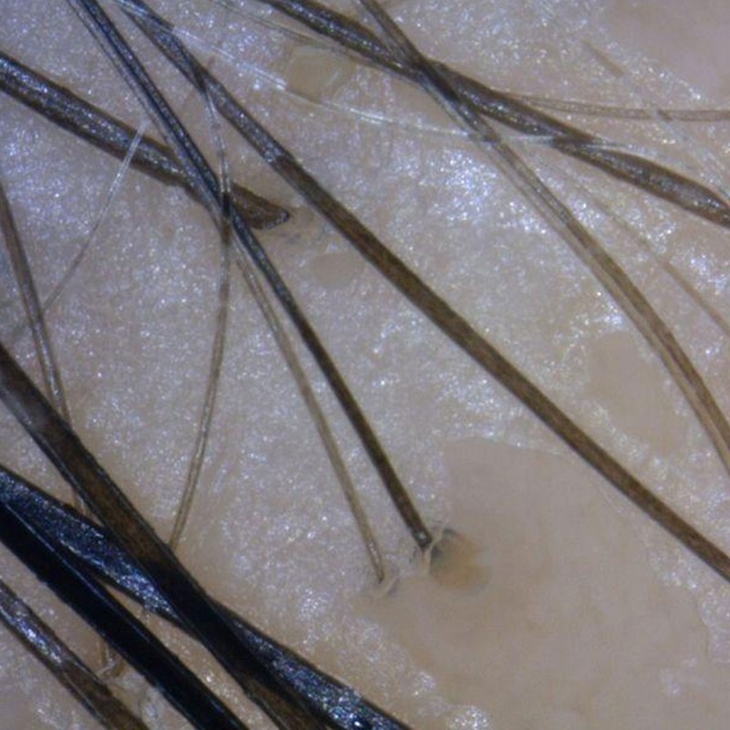 Microscopio Digital Dino-Lite Tricoscopio Basic MEDL3H | Quantum Spain