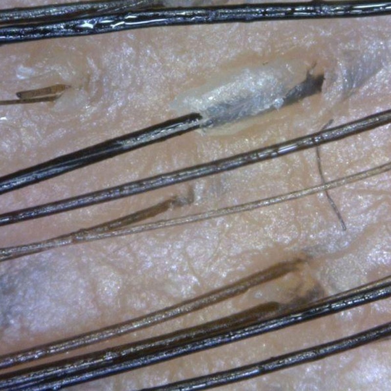 Tricoscopio Dino-Lite TrichoScope Polarizer MEDL4HM | Quantum Spain