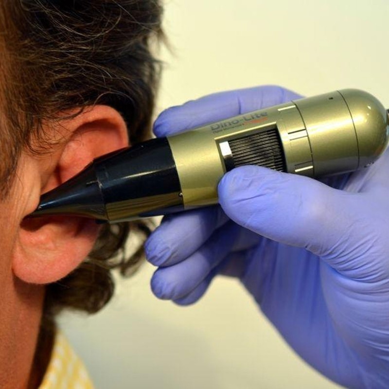 Otoscopio Dino-Lite EarScope Pro MEDL4E | Quantum Spain