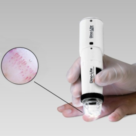 Dino-Lite CapillaryScope 200 Pro Wireless MEDLW4N Pro | Quantum Spain