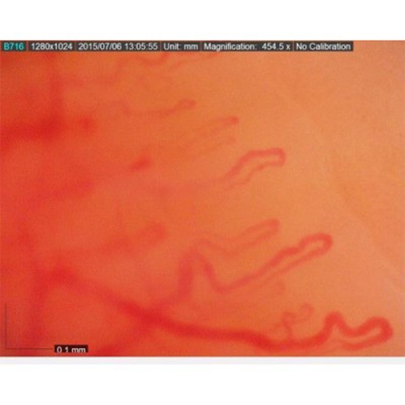 Dino-Lite CapillaryScope 500 Pro Wireless MEDLW4N5 Pro | Quantum Spain